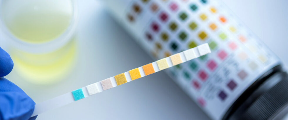 HOW LONG DOES THC STAY IN YOUR SYSTEM? - Medical Marijuana, Inc.